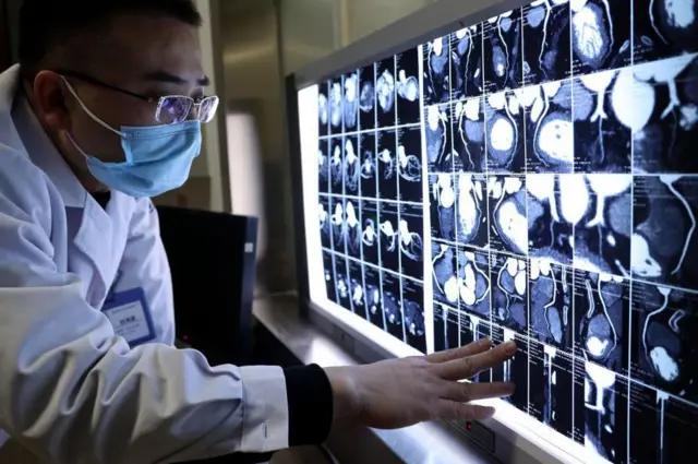 El efecto Compton: el fascinante hallazgo que cambió nuestra ...