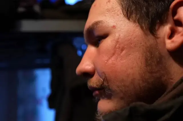 Guerre Ukraine - Russie : La formation d'un jeune héros de l'Ukraine - BBC News Afrique