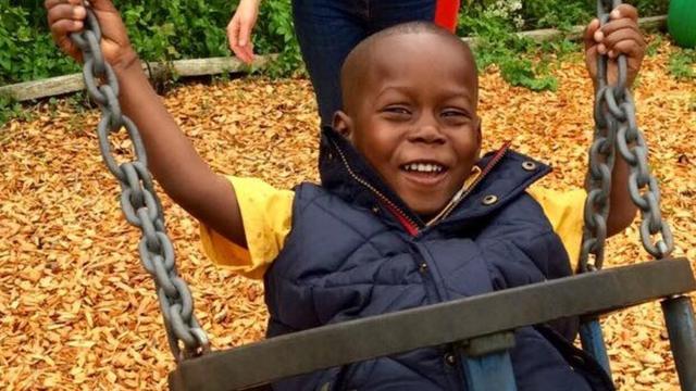 La historia de Ethan, el niño al que los órganos le crecieron fuera del ...