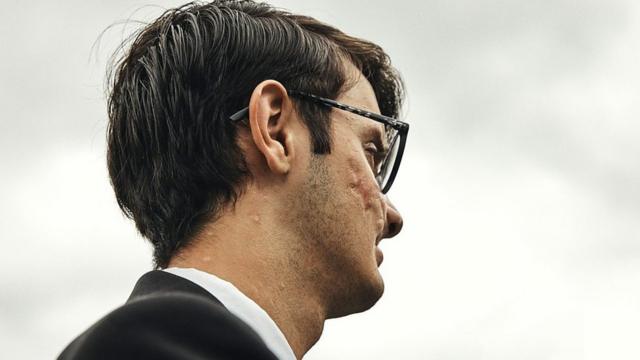 Waleed Khan : "Me dispararon seis veces en la cara y sobreviví" - BBC ...