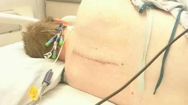 Nem rir, sentar ou ficar de pé: a dor de cabeça que deixou um paciente ...