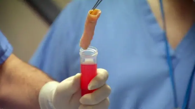 Células madre: la dramática muerte de Shauna Davison tras someterse a ...