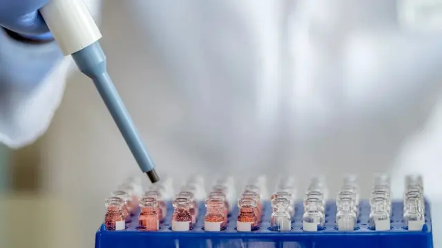 COVID: quelle est l'efficacité d'une dose unique de vaccin? - BBC News ... COVID: quelle est l'efficacité d'une dose unique de vaccin? - BBC News ...