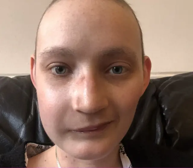 30 yaşındaki genç kadın yüz rekonstrüksiyon ameliyatını anlatıyor ...