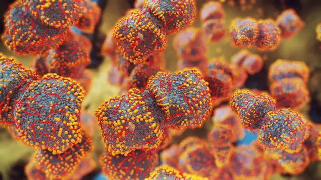 Mpox: Para penyintas cacar monyet berbagi kisah mereka tentang lesi ...