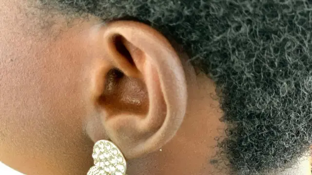 Ear infection: Tinnitus, Otitis externa na ọrịa ndị ọzọ nwereike inye ...