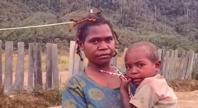 Papua: Puluhan anak terkena campak dan belasan meninggal dunia, pemerintah belum terima laporan ...
