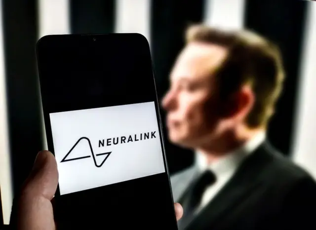 Neuralink De Elon Musk Cómo Funciona Telepathy El Chip Cerebral Que