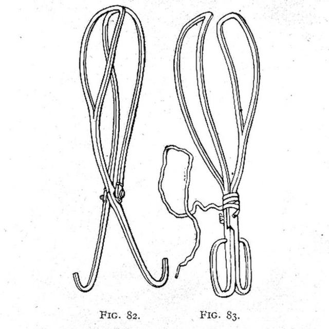 La familia francesa que inventó los fórceps (y por qué lo mantuvo en ...