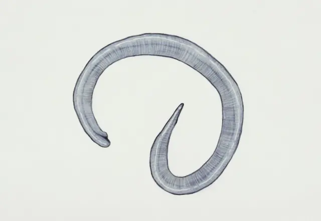 Intestinal Worms: పొట్టలో నట్టలు ఎలా చేరతాయి? వాటిని ఎలా తొలగించాలి ...