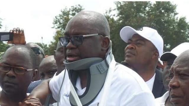 Ayodele Fayose get moto accident for Third Mainland Bridge - BBC News ...