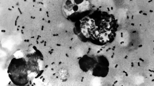 Çin'de iki kişide veba görüldü - BBC News Türkçe