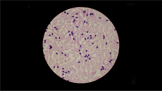 Contraception masculine : Les raisons étranges pour lesquelles il n ...