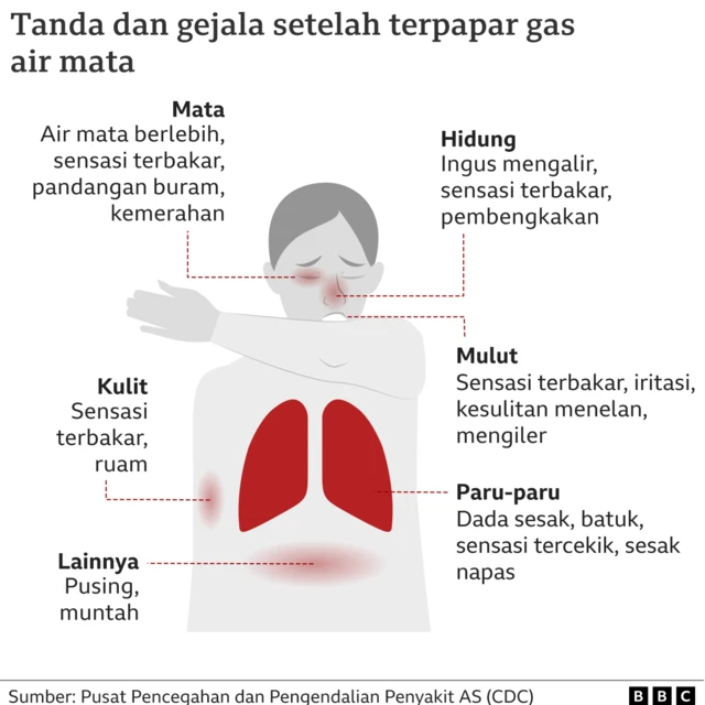 Gas air mata: Fakta-fakta terkait penggunaannya terhadap warga sipil di balik tragedi Kanjuruhan ...