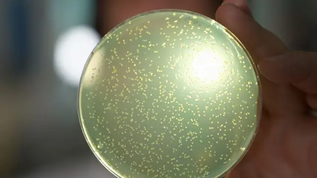 Qacceen sanyii (DNA) nam-tolchee hojjetamuu jalqabe - BBC News Afaan Oromoo