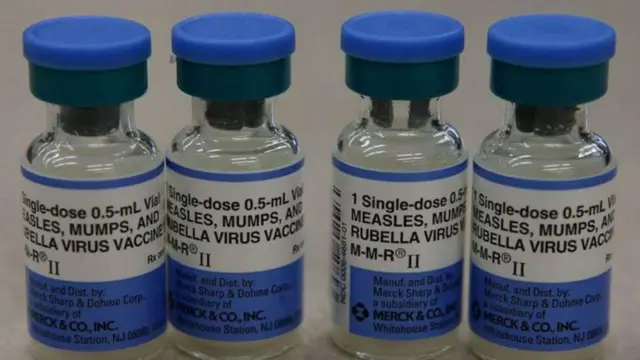 పిల్లల్లో గవదబిళ్లలు ఎందుకు వస్తాయి? లక్షణాలు ఏమిటి? చికిత్స ఎలా ...