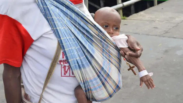 Papua: Mengapa gizi buruk masih menghantui Asmat? - Cerita dari kampung terpencil di pedalaman ...