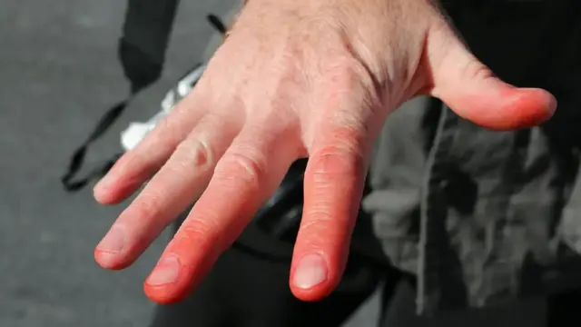 4 razones por las que puedes sentir frío (y cómo varía la temperatura ...