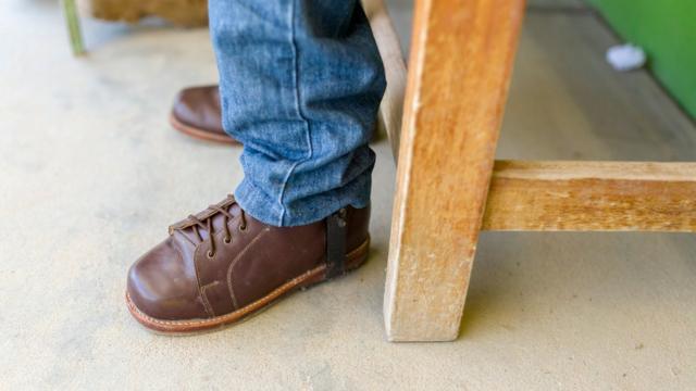 Lucha contra la polio en América Latina: la historia detrás de la foto ...