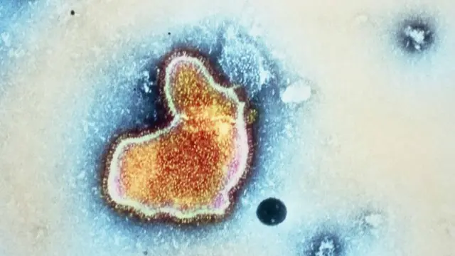 EE.UU. aprueba la primera vacuna del mundo contra el virus respiratorio sincitial, por el que ...