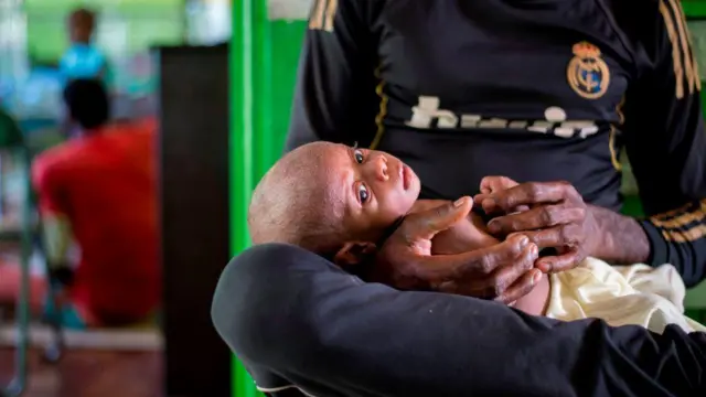 Papua: Mengapa gizi buruk masih menghantui Asmat? - Cerita dari kampung terpencil di pedalaman ...