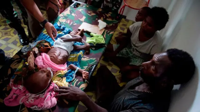 Papua: Mengapa gizi buruk masih menghantui Asmat? - Cerita dari kampung terpencil di pedalaman ...