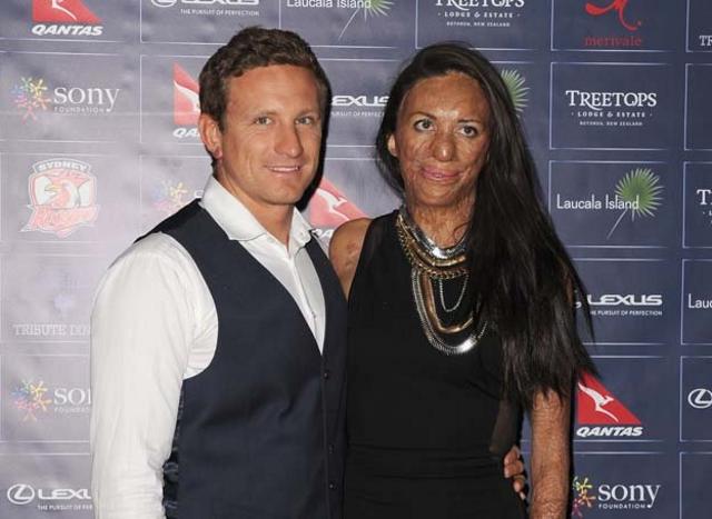 La extraordinaria hazaña de Turia Pitt, la mujer que pasó por 200 ...