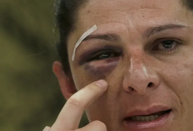 Lo Que Revela La Golpiza A La Medallista Olímpica Ana Gabriela Guevara