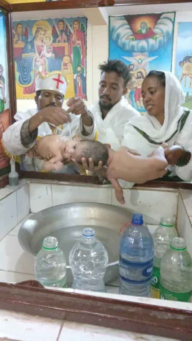 ትግራይ፡ ተላጊበን ዝተወልዳ ህያብን ውህብቶን ድሕሪ 80 መዓልታት ከመይ ኣለዋ Bbc News ትግርኛ