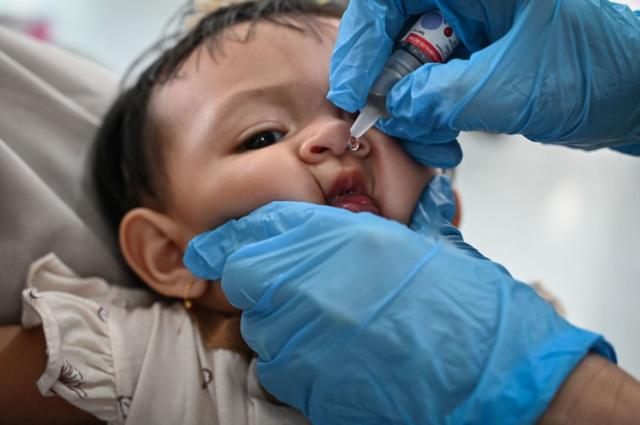 Polio: Tiga anak di Jateng dan Jatim lumpuh layu - Apa gejalanya dan ...