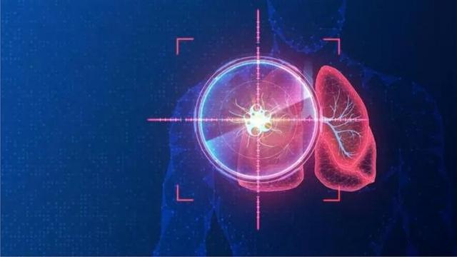 Cancer : quatre bonnes nouvelles pour les malades - BBC News Afrique