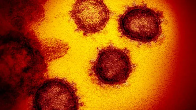Qué son los coronavirus, cuántos hay y qué efectos tienen sobre los humanos - BBC News Mundo