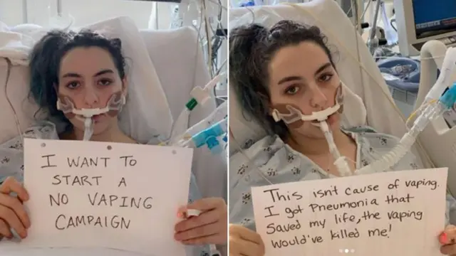 전자담배: 미국에서 급증하는 전자담배 질환, 원인은 무엇인가? - BBC News 코리아