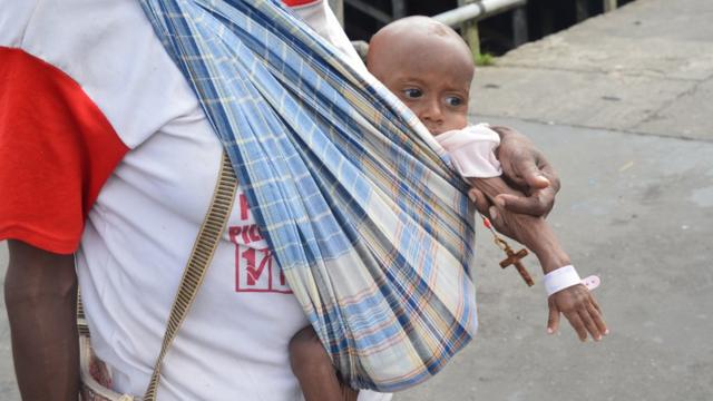 Melihat anak-anak di Asmat yang dilanda wabah campak dan gizi buruk - BBC News Indonesia