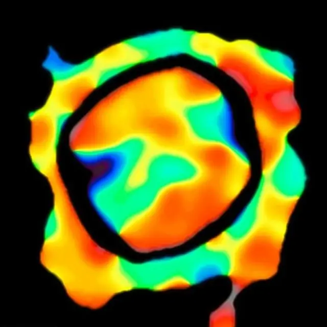 La impresionante imagen de Antares, la estrella agonizante que se está ...