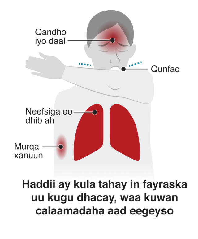 Calaamadaha Korona Fayras: Maxay yihiin, sideena nafteyda uga ilaalin ...