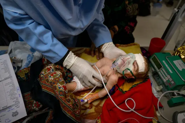 Afghanistan: Bencana kelaparan melanda, 3,2 juta bayi alami malnutrisi akut, para ibu kehilangan ...