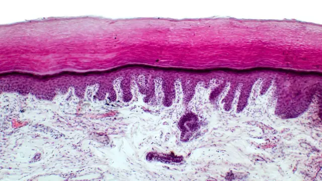 Salud: las curiosas formas en que tu piel define cómo están tu cuerpo y ...
