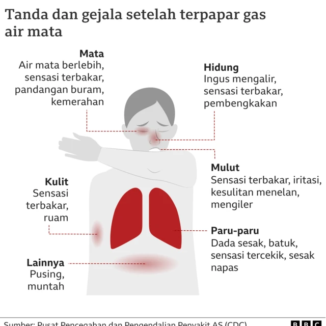 Saksi kerusuhan setelah pertandingan Arema-Persebaya: 'Suara tembakan gas air mata banyak banget ...