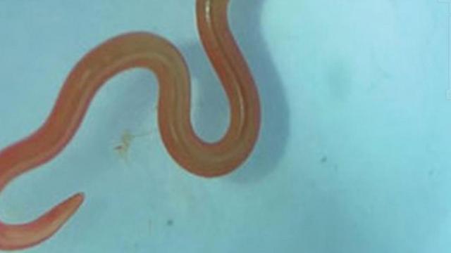 மலைப்பாம்பில் வாழும் 'ஒட்டுண்ணி புழு' பெண்ணின் மூளைக்குள் எப்படி வந்தது ...