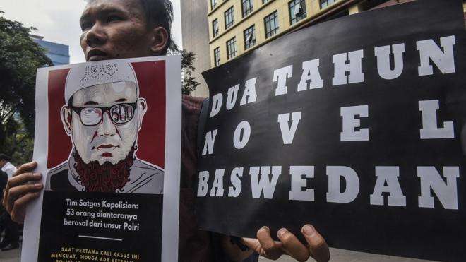 Kasus Novel Baswedan: Kerusakan mata Novel karena 'kesalahan penanganan ...