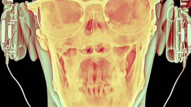 Je, nta wa sikio unaweza kufichua maradhi uliyonayo? - BBC News Swahili