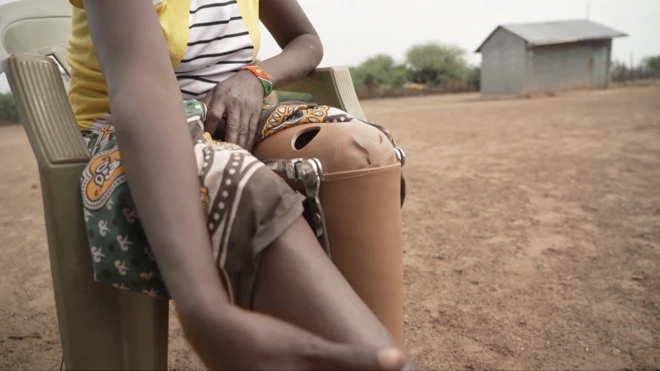 Australian farmer survive crocodile attack by biting back di animal ...