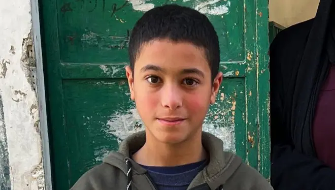 Israel-Palestina: Nasib anak-anak Gaza yang terluka dan kehilangan orang tua akibat perang ...