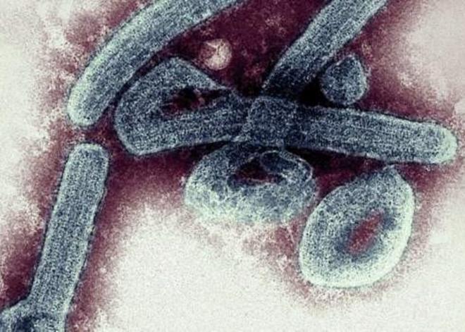Virus de Marburg : la Guinée équatoriale confirme la première flambée épidémique de la maladie ...