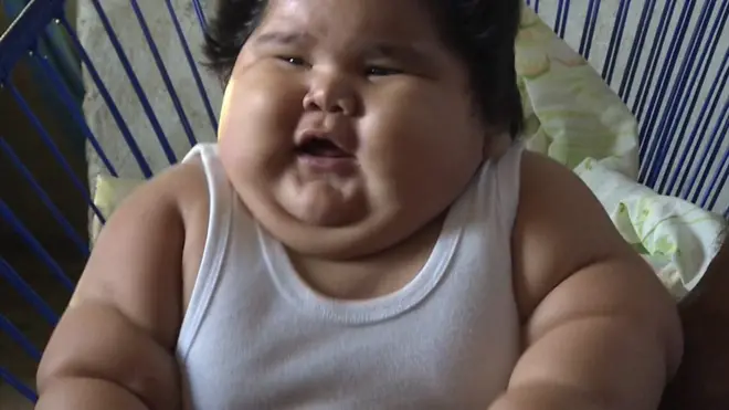 Cómo se explica la obesidad de Luis Manuel, el bebé mexicano que a los 11 meses pesa 28 kilos ...