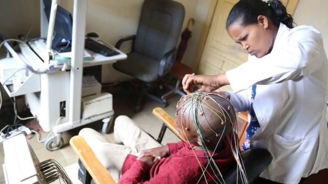 Fayyaa sammuu: Dhiphinni sammuu maali? Furmaanni isaahoo? - BBC News ...