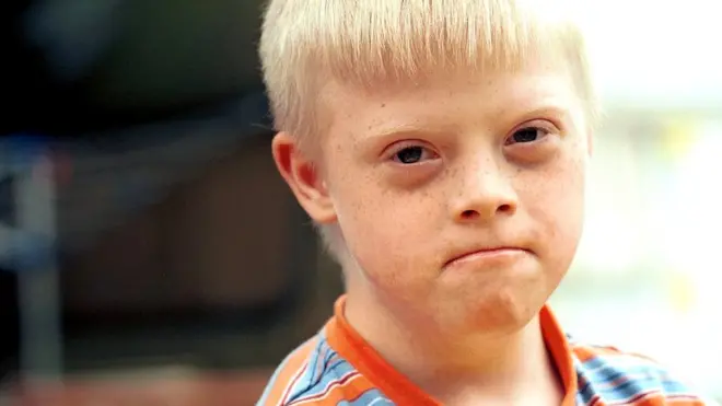 "¿Por qué mi vida es menos valiosa?": la lucha de Heidi Crowter por evitar que los fetos con ...