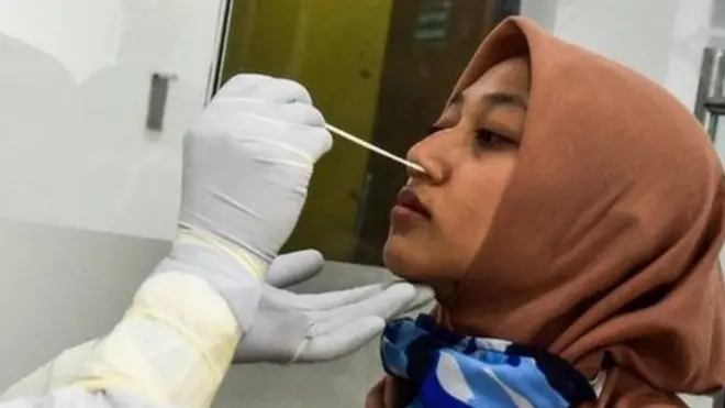 Covid-19 tanpa simtom: Kerusakan pada paru-paru terhadap pasien virus corona tanpa gejala, yang ...