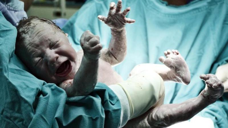 Transtorno pós-parto: por que ocorre e como combater - BBC News Brasil